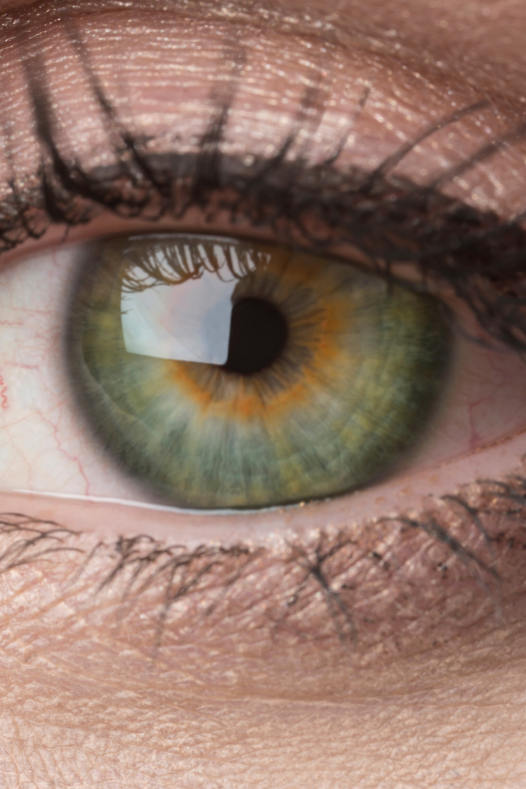 La genética del color de ojos es muy complicada. - Iris Color Laser