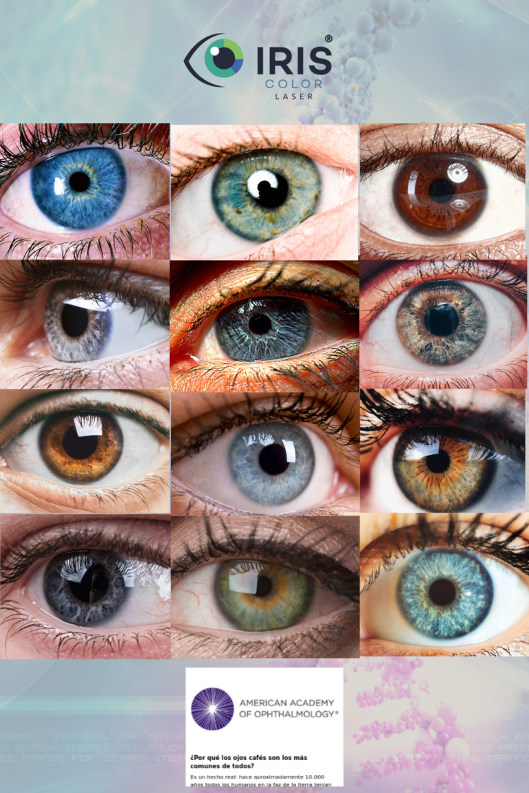 The genetics of eye color is very complicated. - Iris Color Laser